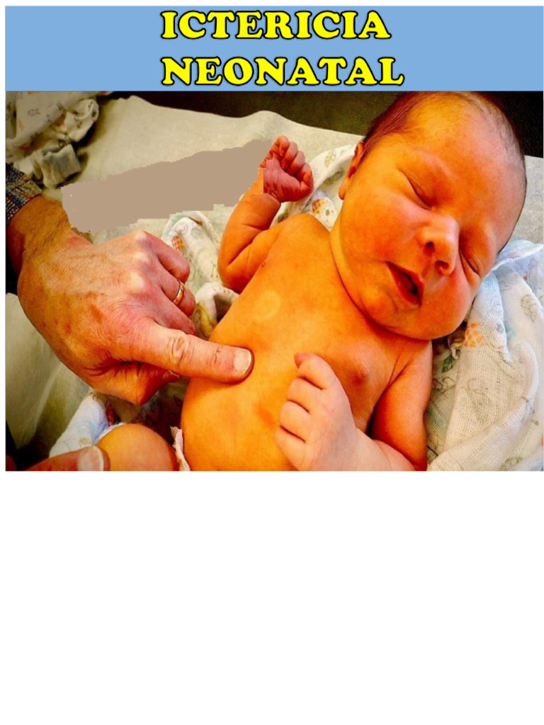 Neonatal Icterus | PDF | Medical Specialties | Diseases And Disorders