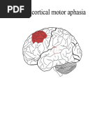 Aphasia Screening Test (MAST) Score Sheet | PDF | Cognitive Science ...