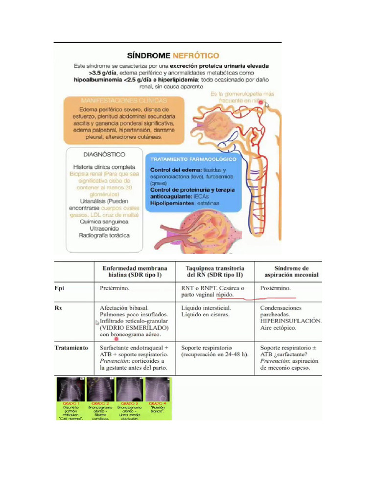 Flascard | PDF