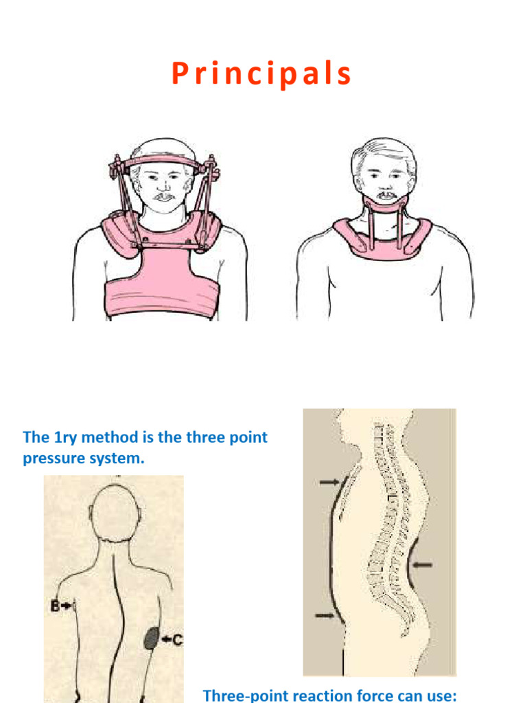 Spinal orthosis manipulation | PDF | Vertebra | Musculoskeletal System