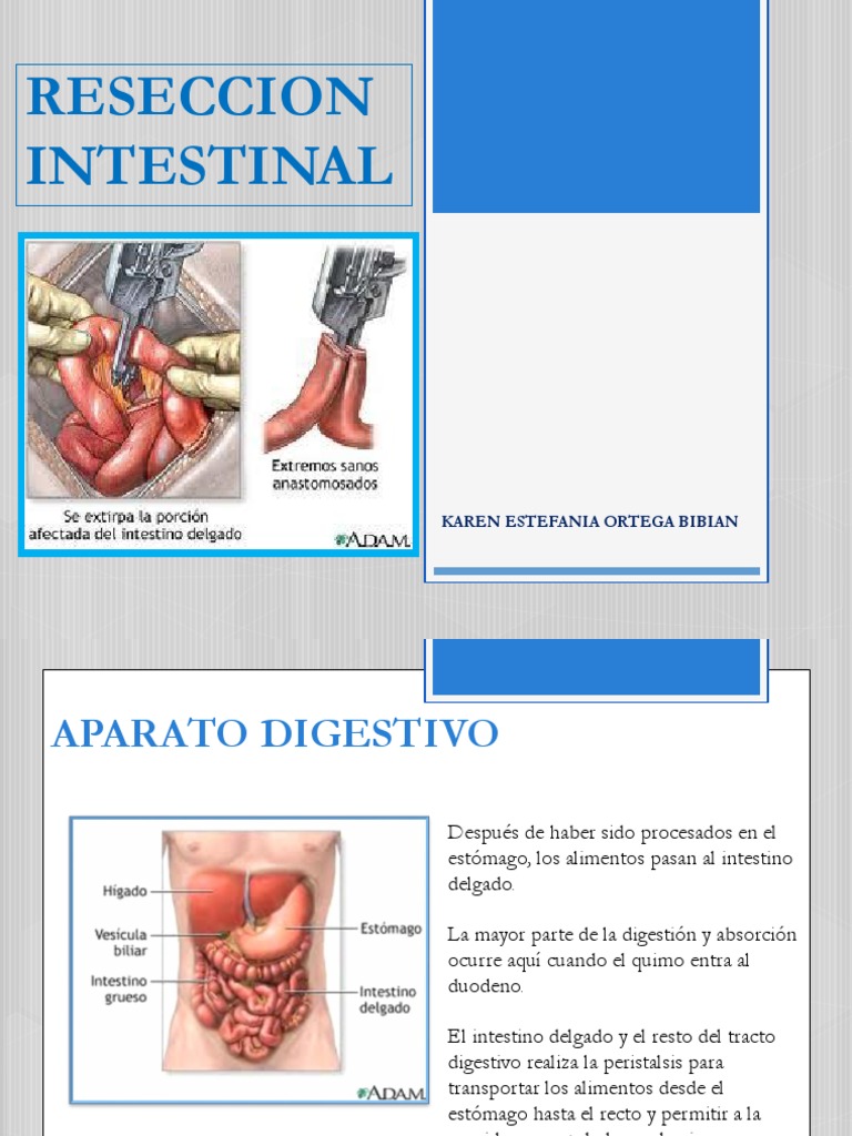 Guía de Resección Intestinal | PDF | Digestión | Intestino delgado