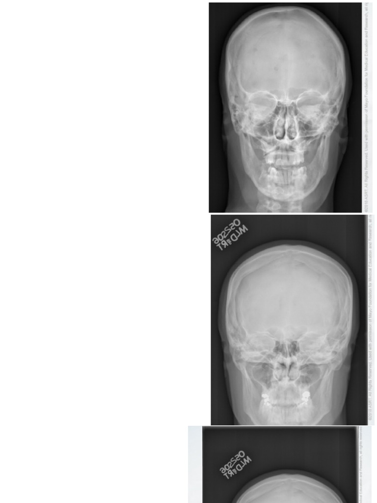 Skull Exam Review (2025) | PDF