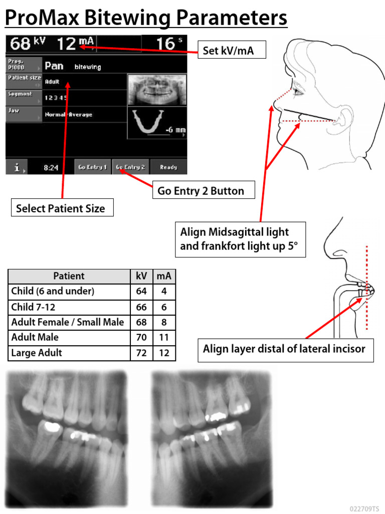 ProMax Bitewing Images | PDF
