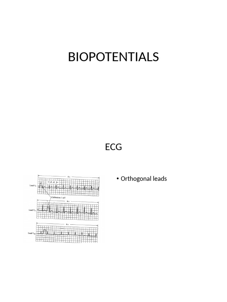 ECG Analysis and Interpretation Guide | PDF