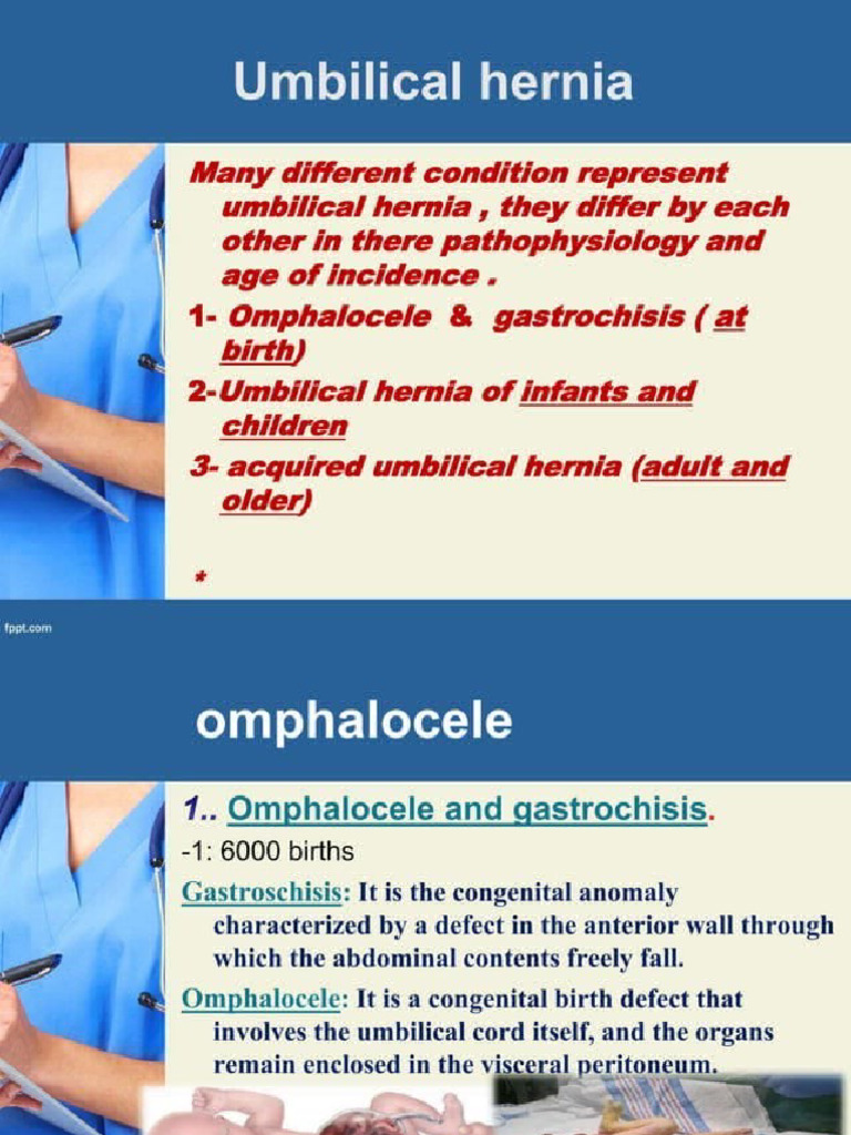 Abdominal Wall Hernia | PDF