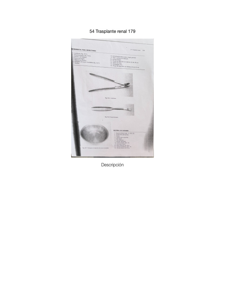 54 Trasplante Renal 179 | PDF