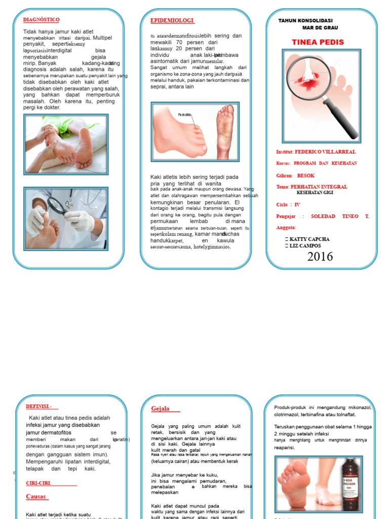 Kaki Atlet: Gejala dan Perawatan Efektif | PDF