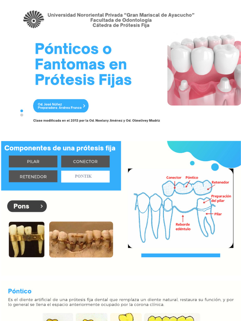 KELAS Ponticos Protesis Tetap II | PDF