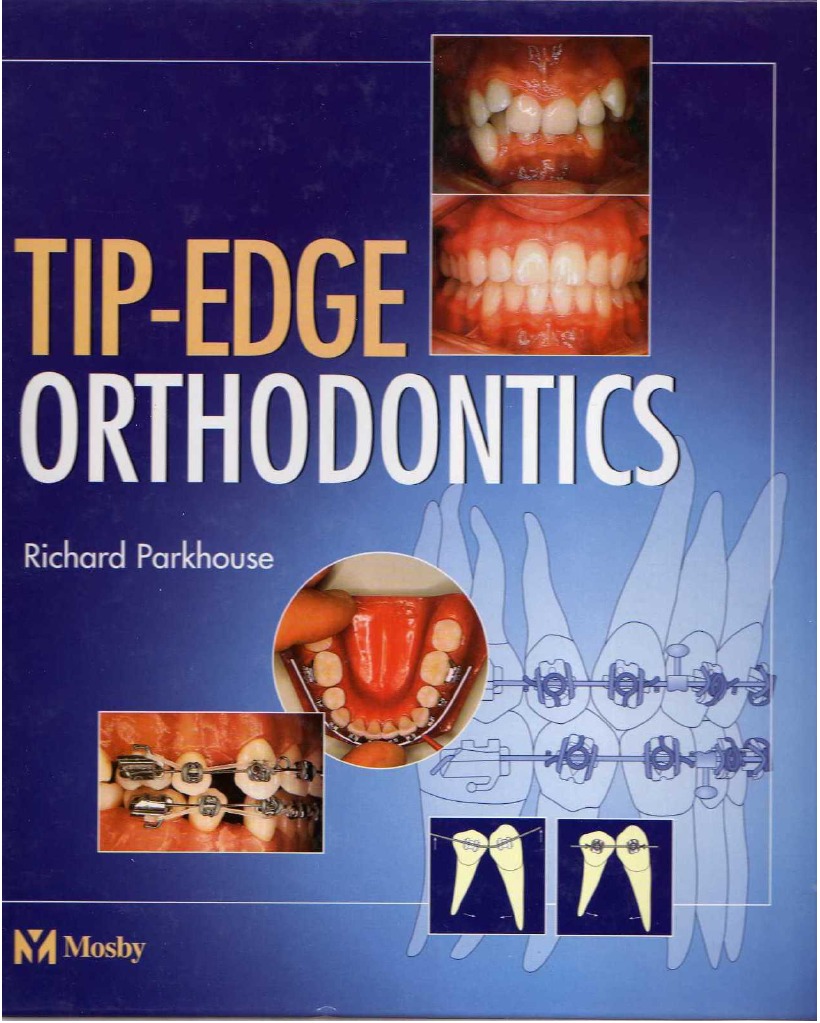 Tip Edge Orthodontics | PDF