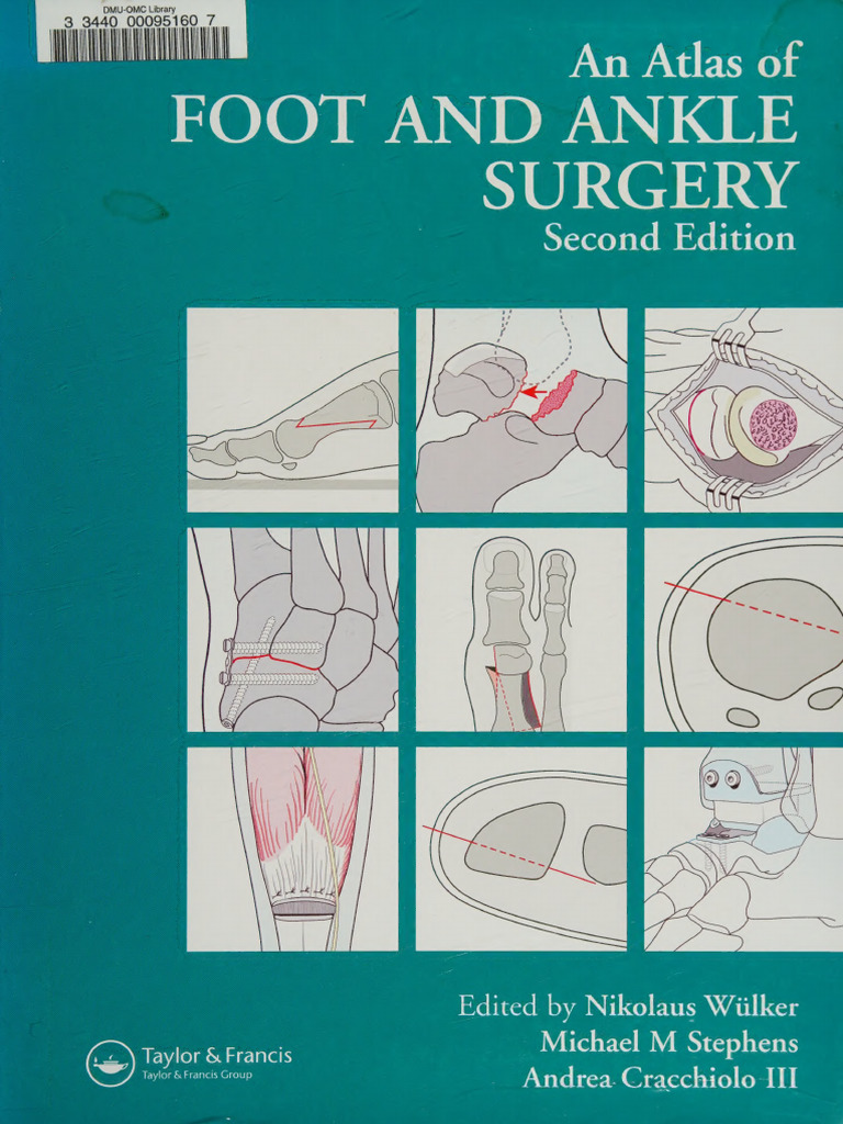 Foot and Ankle Surgery Atlas, 2nd Ed. | PDF | Toe | Anatomical Terms Of ...