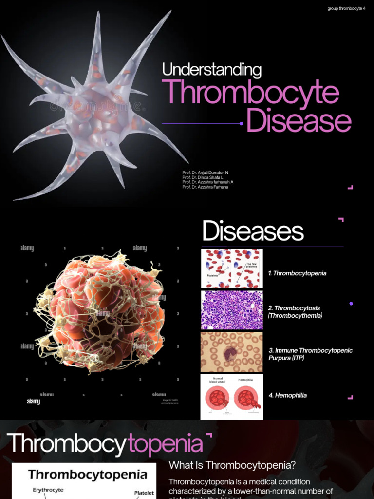 Thrombocyte Disease 0 | PDF | Platelet | Bleeding