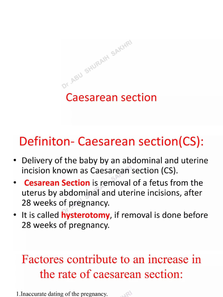 Caesarean Section Pdf