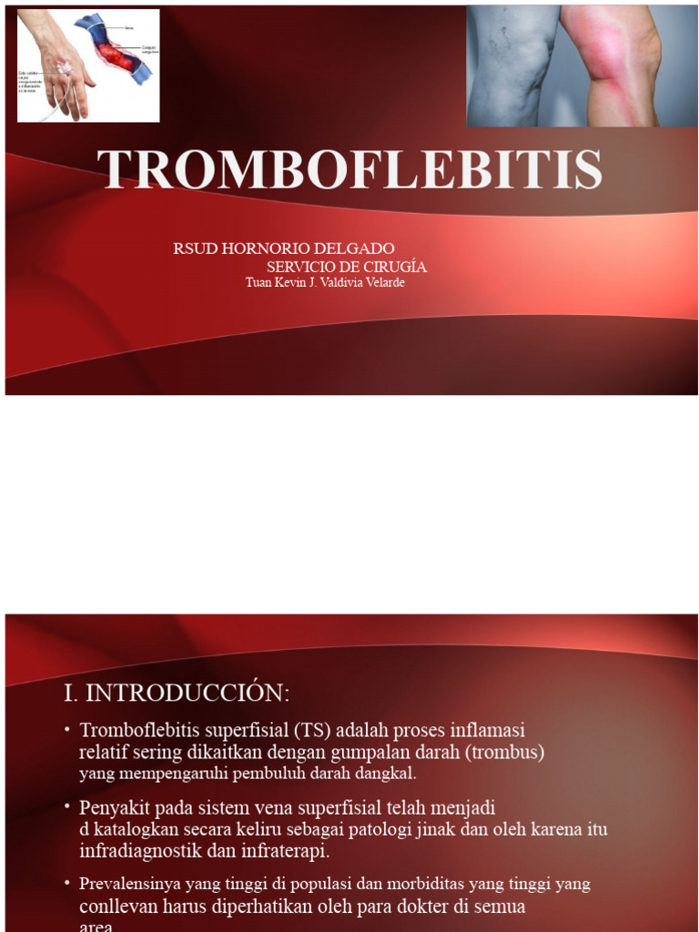 TROMBOFLEBITIS | PDF