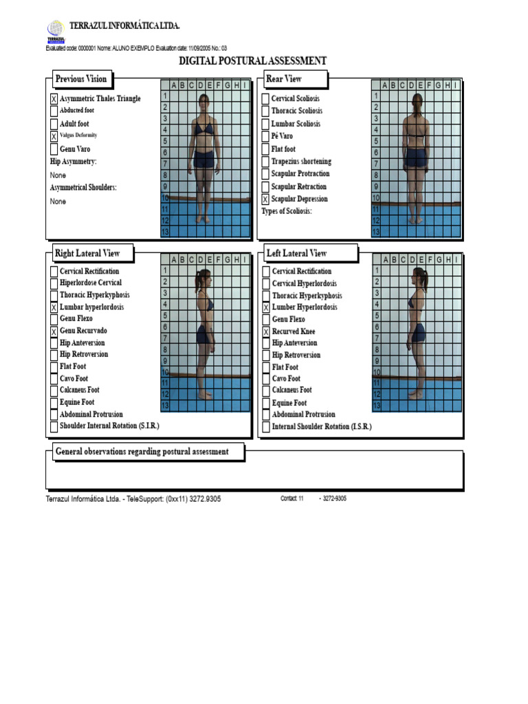 Digital Postural Assessment Report | PDF | Scoliosis | Foot