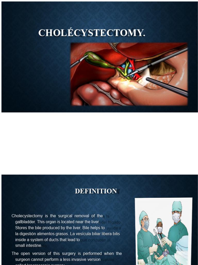 Cholecystectomy | PDF | Gallbladder | Abdomen
