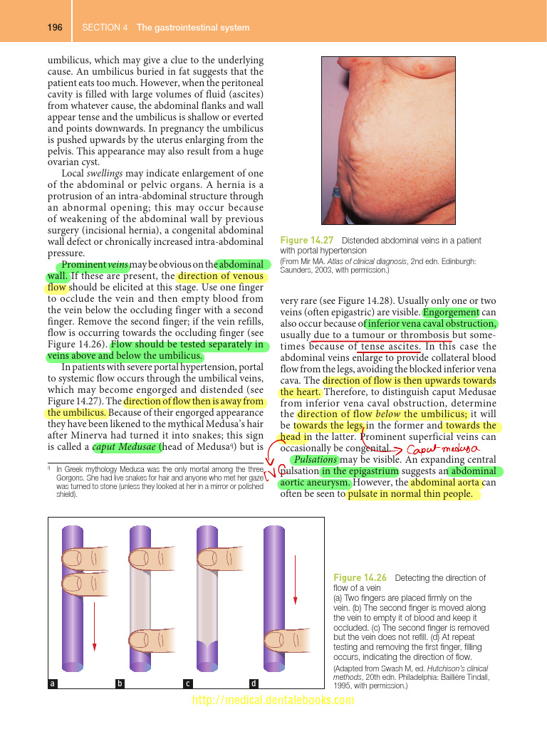 SVC Obstruction IVC Obstruction and Portal HTN Detection | PDF | Vein ...