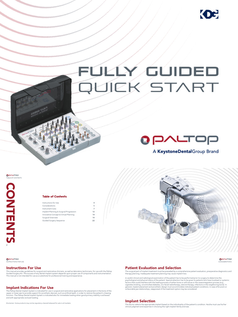 PALMTOP FullyGuided | PDF | Dental Implant | Surgery