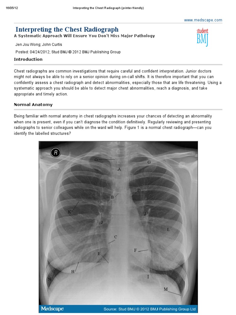 Interpreting The Chest Radio Graph Friendly) | PDF | Lung | Thorax