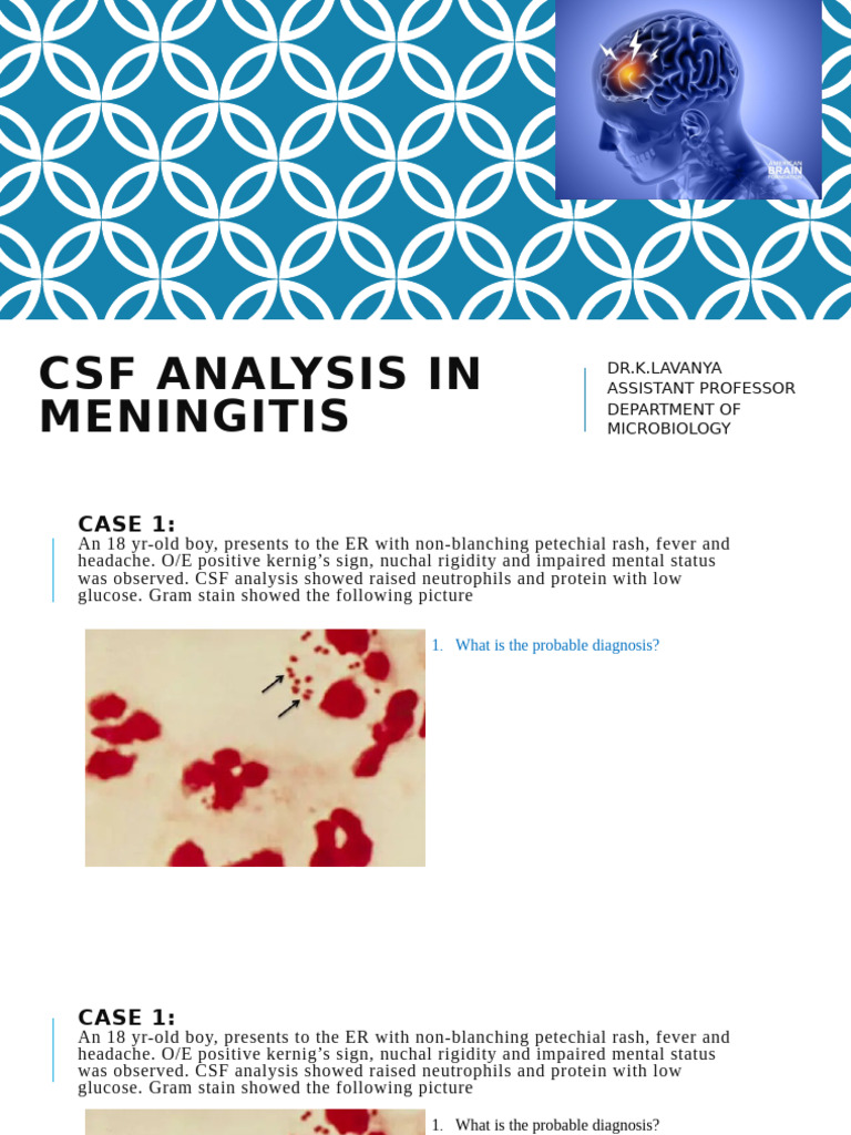 Csf Analysis - Copy (2) | PDF | Meningitis | Cerebrospinal Fluid