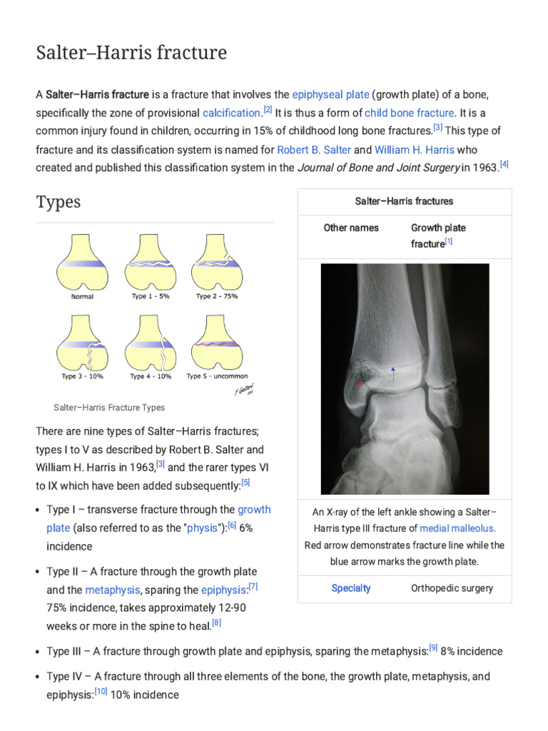 Salter-Harris Fracture - Wikipedia | PDF | Bone | Musculoskeletal Disorders