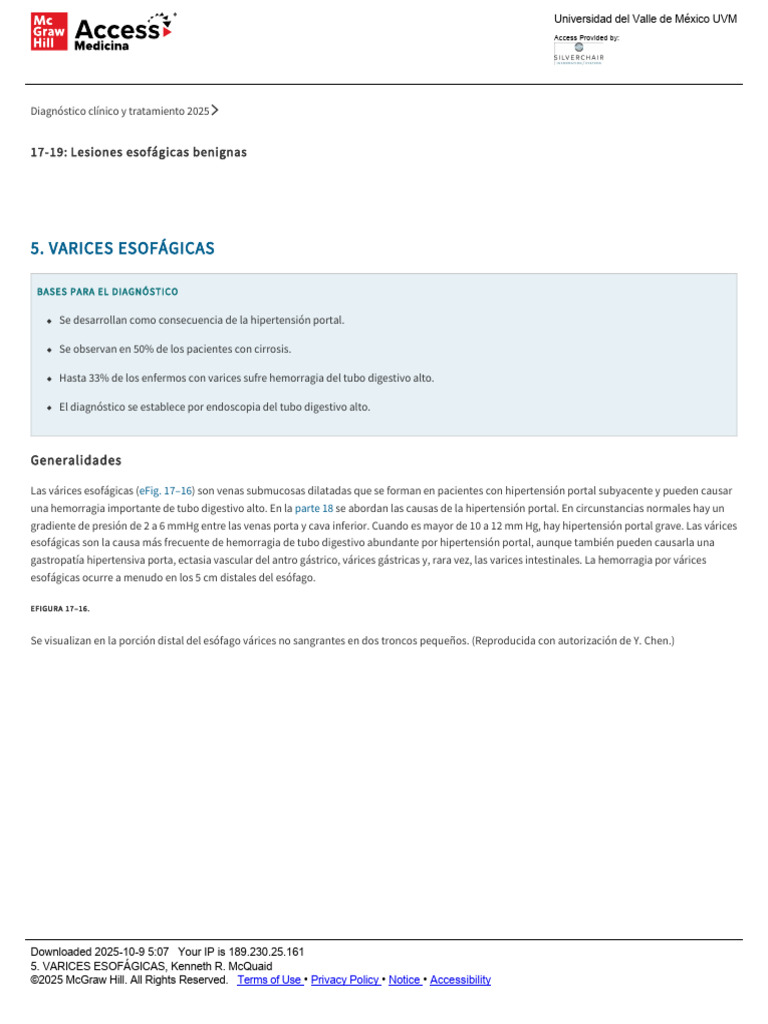 Varices esofágicas: diagnóstico y tratamiento | PDF | Enfermedades y ...