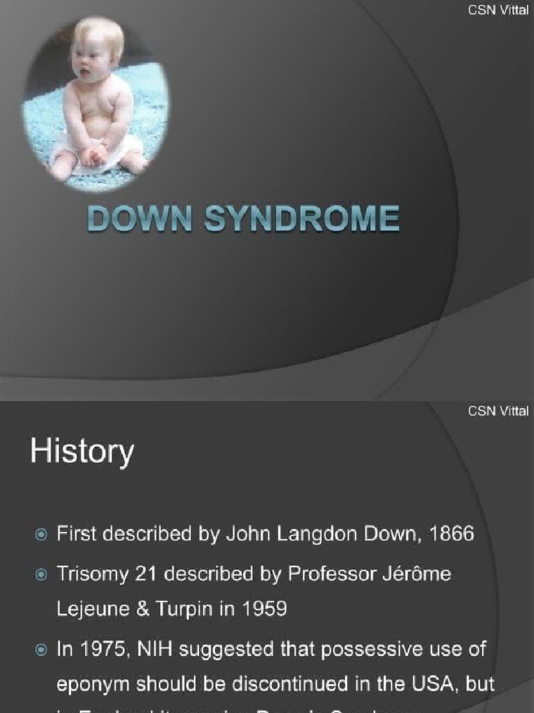 Down Syndrome | PDF