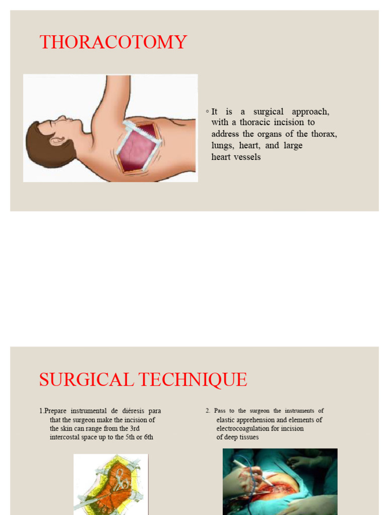 Thoracotomy | PDF