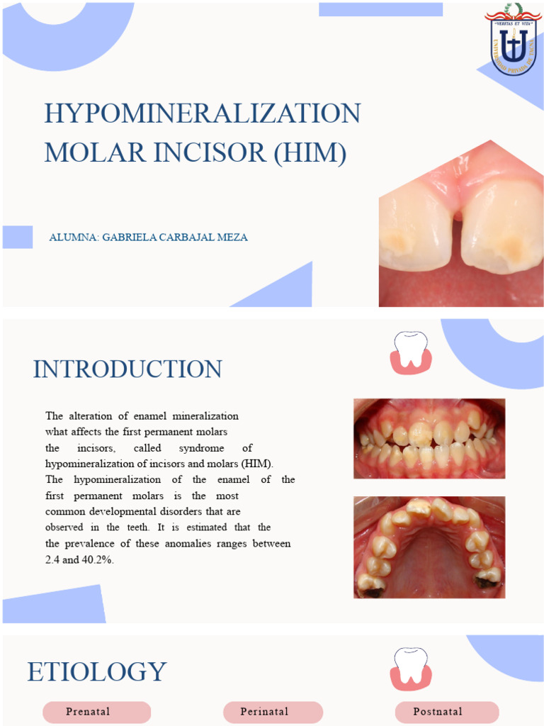INCISOR MOLAR HYPOMINERALIZATION (Him) - 2 | PDF | Human Tooth | Tooth ...