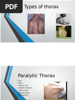 Types of Chest Shapes Explained | PDF | Thorax | Causes Of Death