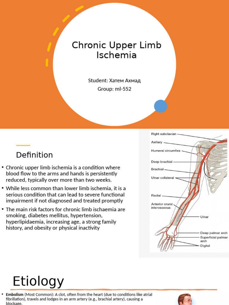 Chronic Upper Limb Ischemia: Student: Хатем Ахмад Group: ml-552 | PDF ...