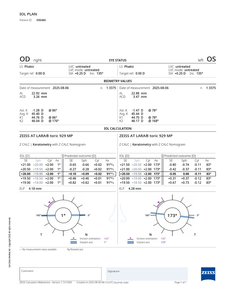EDOF TORIC calculation | PDF | Eye | Vision
