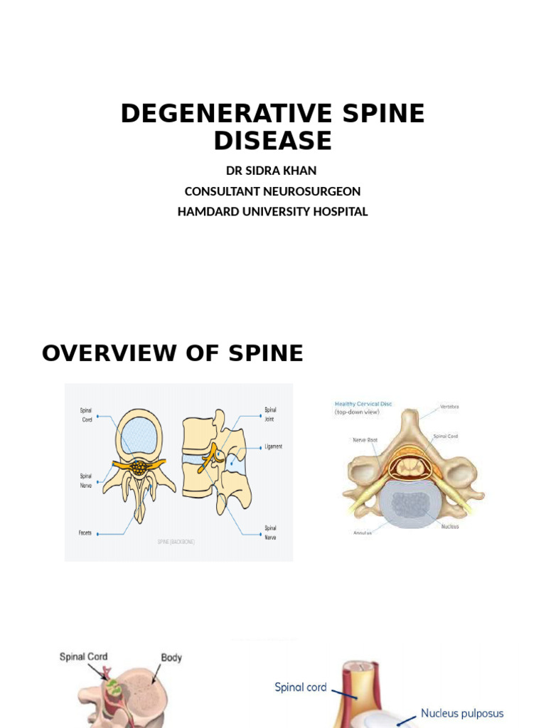 Degenerative Spine Disease | PDF | Vertebra | Back Pain