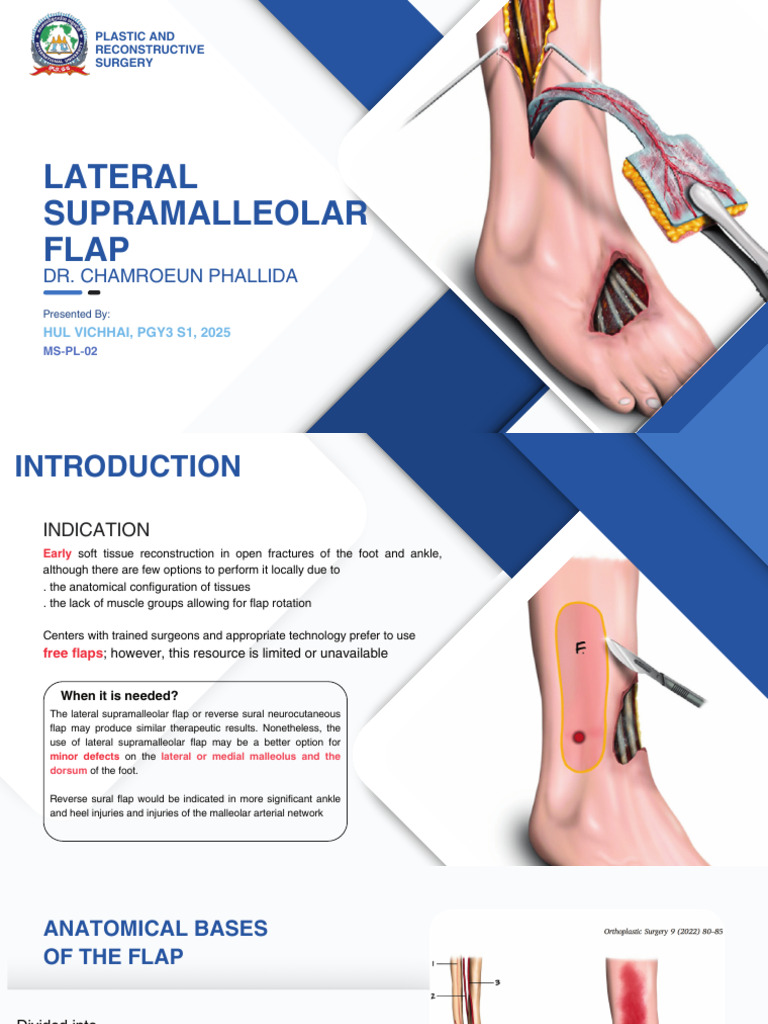 Lateral Supramalleolar Flap | PDF | Ankle | Anatomical Terms Of Location