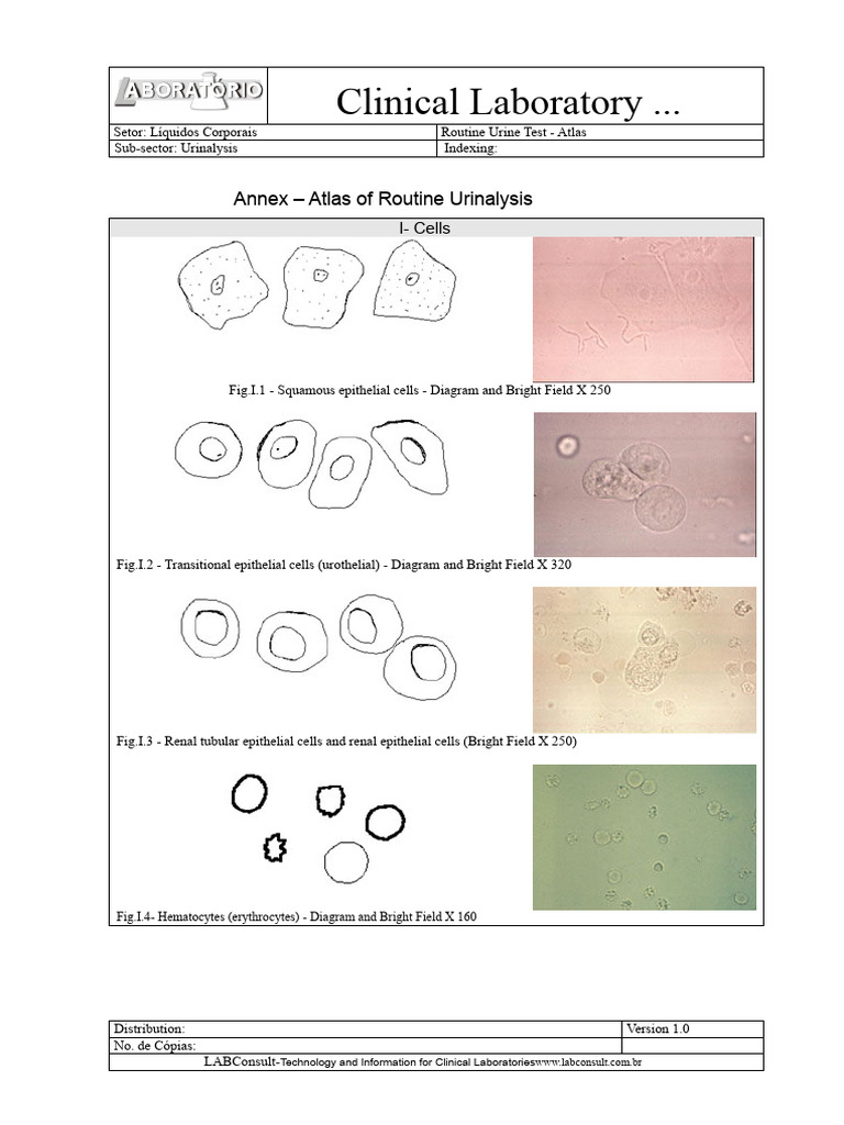 Atlas of Routine Urine Examination | PDF | Urinary System | Medical ...