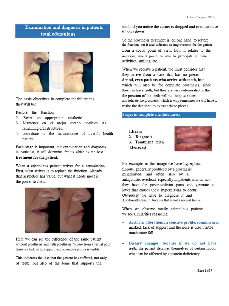 Complete Edentulous Diagnosis Guide | PDF | Dental Implant | Medical ...