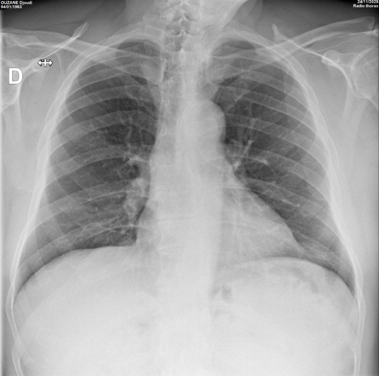 03 01 0001 IMAGES Radio Thorax 816531 | PDF