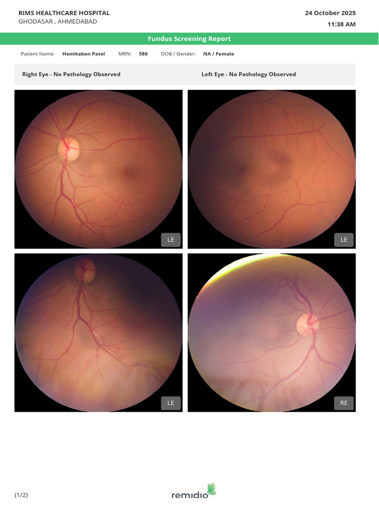 Fundus Screening Report: Ghodasar, Ahmedabad | PDF