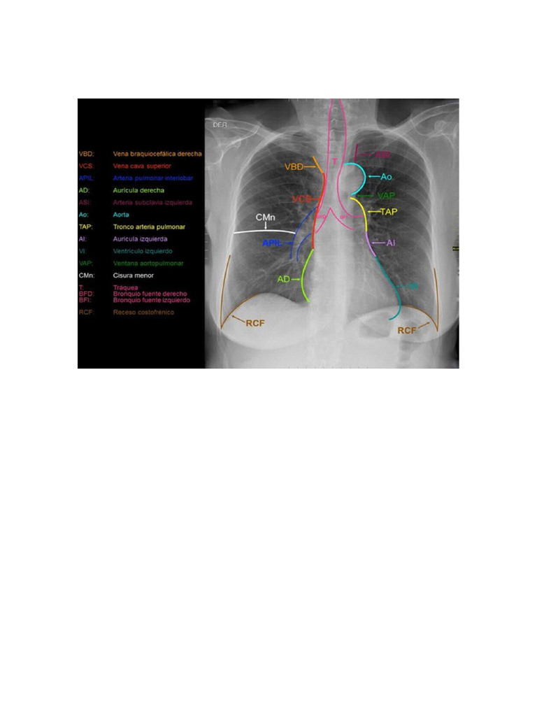 Copia de Imagenes de RX de Torax | PDF | Extremidades (anatomía ...