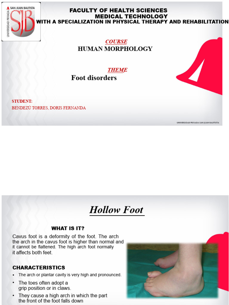 Foot Abnormalities | PDF | Foot | Limbs (Anatomy)