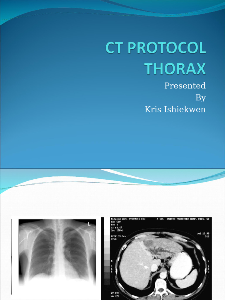 CT Protocol Thorax | PDF | Ct Scan | Thorax