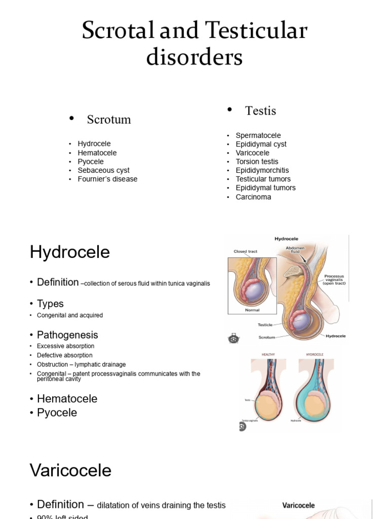 Scrotal and Testis Disorders | PDF