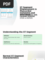 J-Point and STEMI Criteria Explained | PDF | Electrocardiography ...