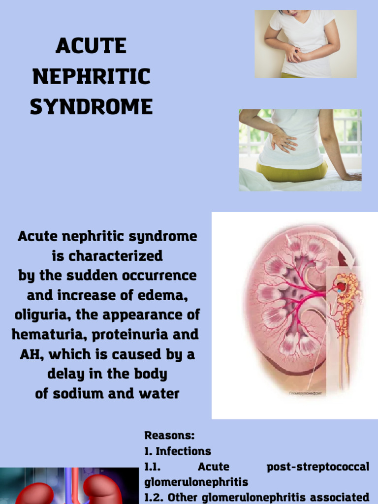 Acute Nephritic Syndrome | PDF | Diseases And Disorders | Immunology