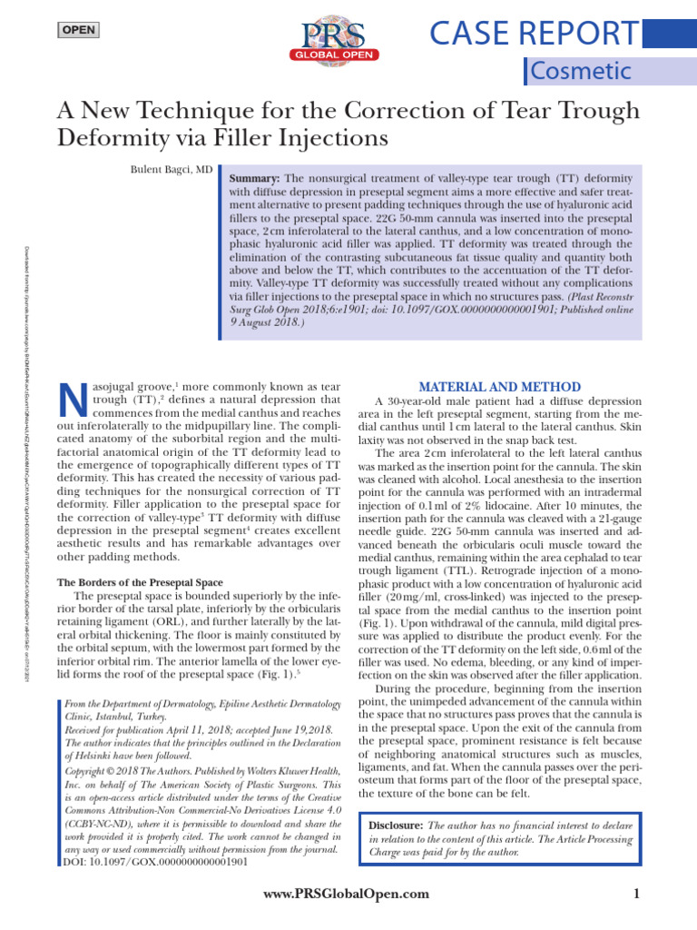 A New Technique For The Correction of Tear Trough.30 | PDF