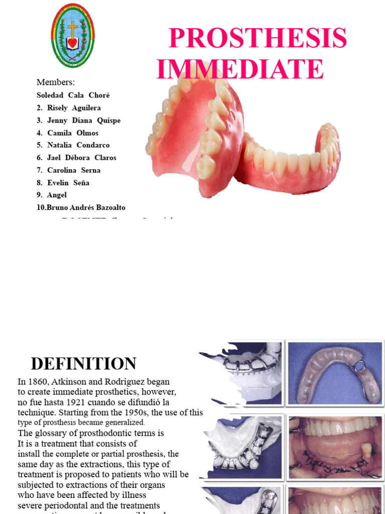 Immediate Prosthesis Ppt | PDF | Prosthesis | Dental Implant