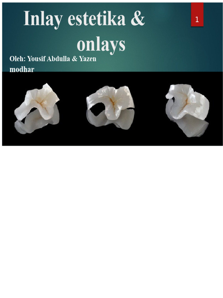 Panduan Inlay dan Onlay Gigi | PDF