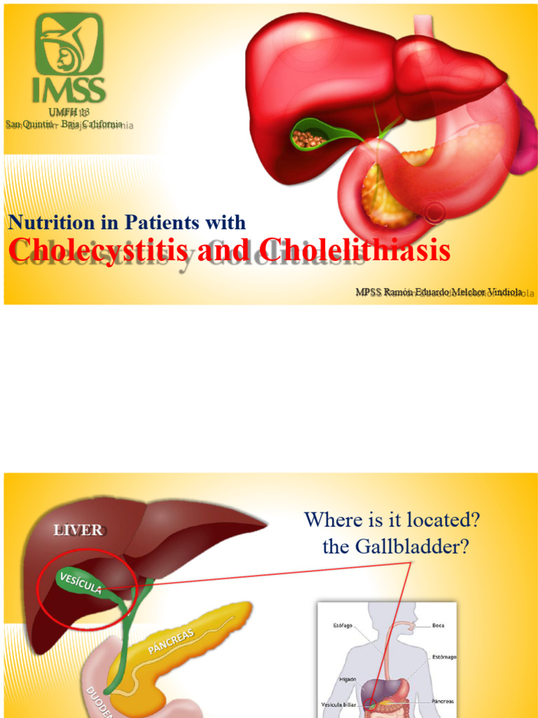 Nutrition in Patients With Cholecystitis and Cholelithiasis ...