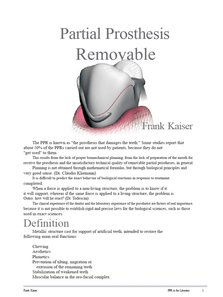 Understanding Partial Prostheses: Key Insights | PDF | Dental Implant ...