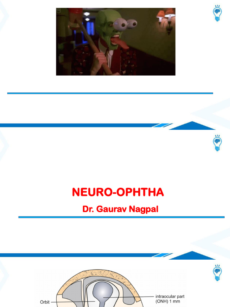 Fmge Ophtha Day-3 Unannotated - 250911 - 193145 | PDF | Retina ...