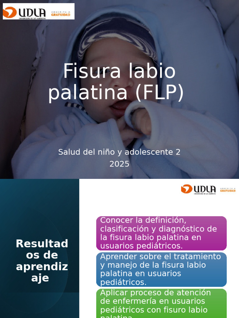 Fisura Labio Palatina: Diagnóstico y Tratamiento | PDF | Nariz humana